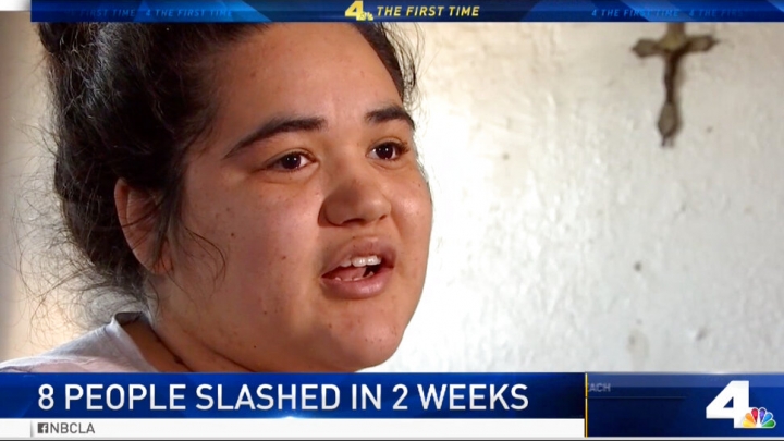 Bike-riding face slasher charged in Los Angeles - China Plus